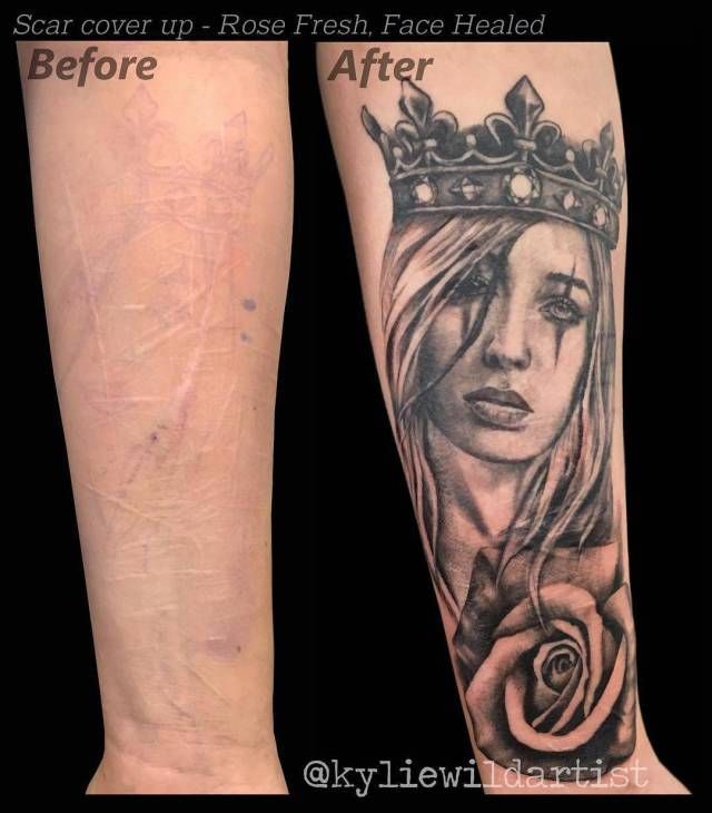 220+ Beautiful Scar Cover Up Tattoos Designs (2024) - TattoosBoyGirl