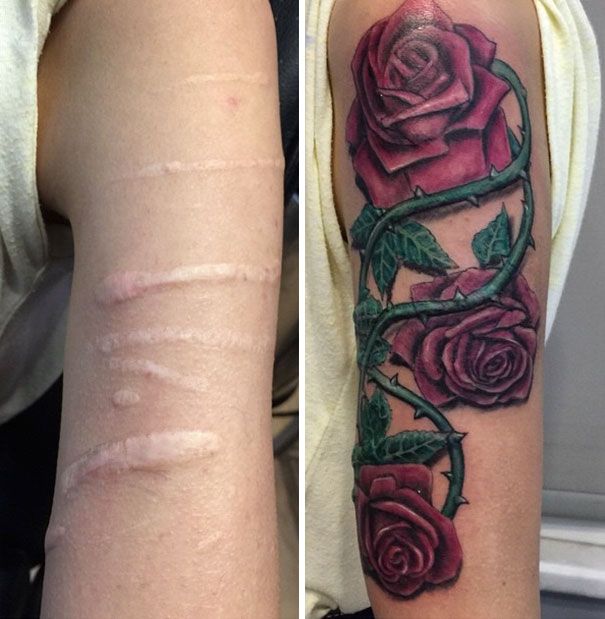 220+ Beautiful Scar Cover Up Tattoos Designs (2024) - TattoosBoyGirl