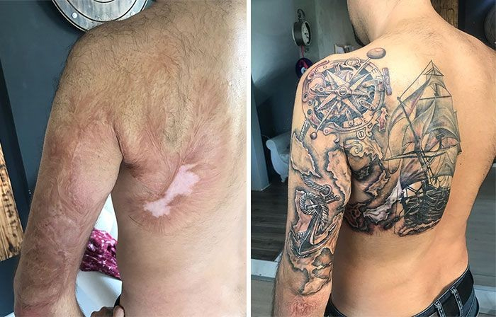 220+ Beautiful Scar Cover Up Tattoos Designs (2024) - TattoosBoyGirl